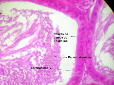 Embriologia Geral: ESPERMATOGÊNESE