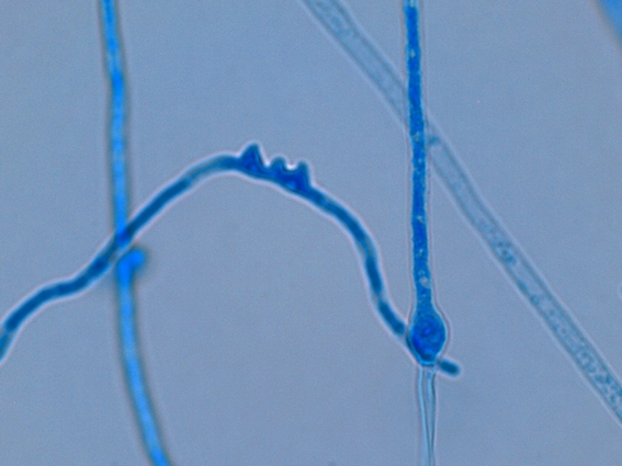 Fun With Microbiology (What's Buggin' You?): Microsporum audouinii
