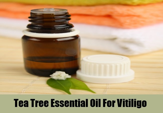 5 USEFUL HERBAL REMEDIES FOR VITILIGO ~ Mzizi Mkavu