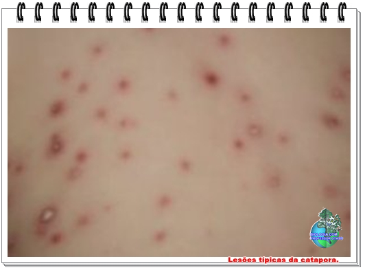 Biologia com Professor Otavio: CATAPORA