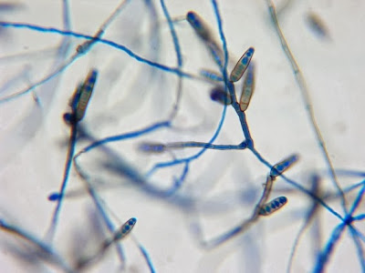 Fun With Microbiology (What's Buggin' You?): Exserohilum rostratum