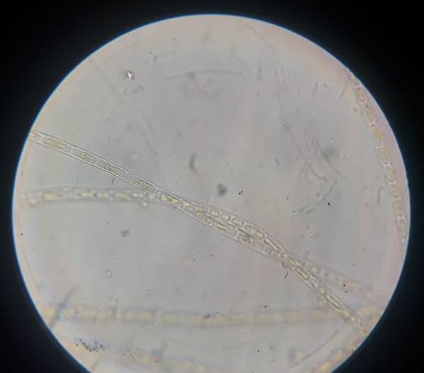 Informe Biología Vegetal I: 2018