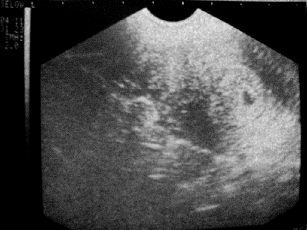 January 2012 Moms: Ultrasound Gallery
