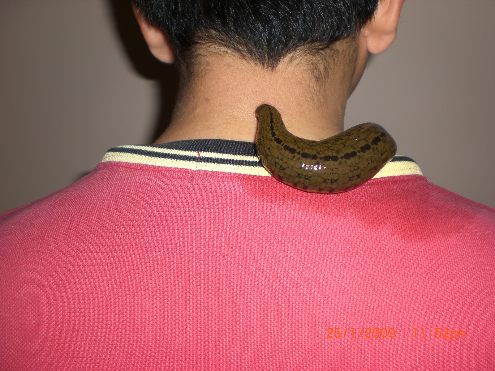 TakeCare!: LEECH THERAPY IN MALAYSIA - Painless Ancient Treatment