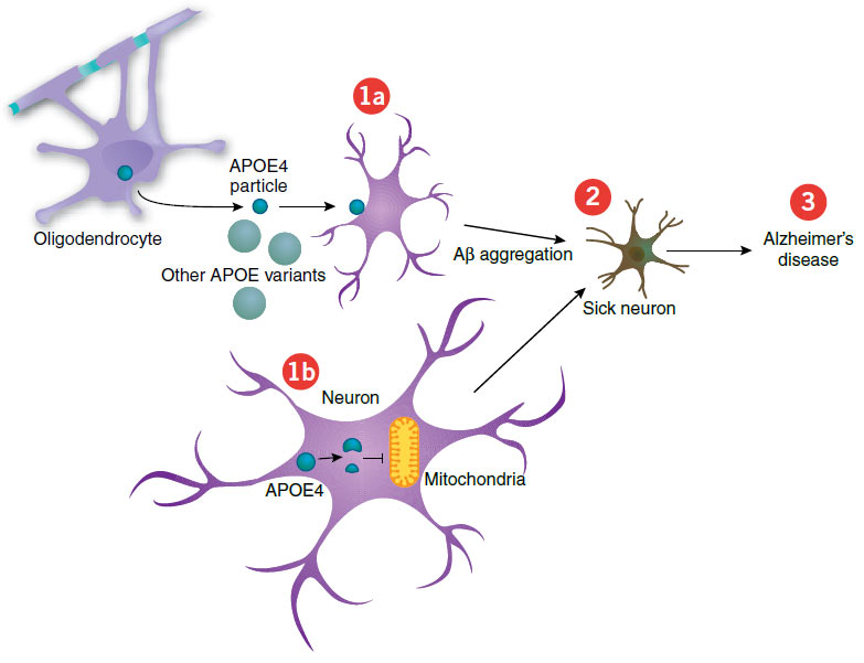 Mal de Alzheimer: Alipoproteína E ( ApoE) Relacionada a DA