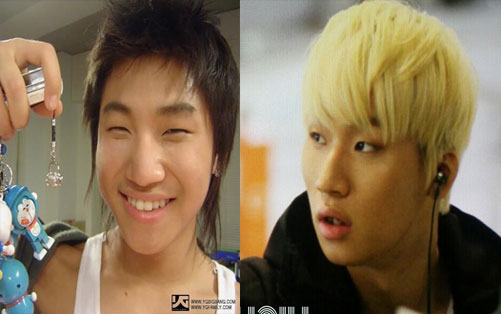Kpop Star Daesung Big Bang Plastic Surgery | Kpop Plastic Surgery
