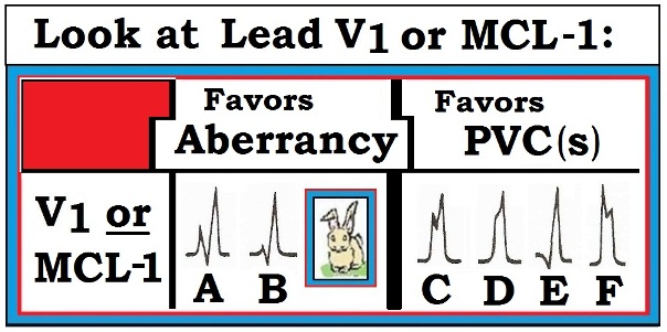 ECG Interpretation: ECG Blog #71 (PVC – AFib – Ashman – Aberrancy)