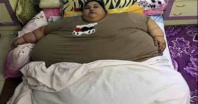 World's fattest woman who weighs 500kg loses 65kg in 2months ...