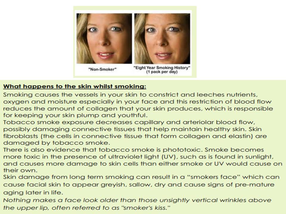 Bodytique An essential treatment: Effects of smoking on skin health