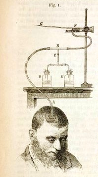 Altered Haemodynamics: Understanding cervical arterial dysfunction (CAD ...