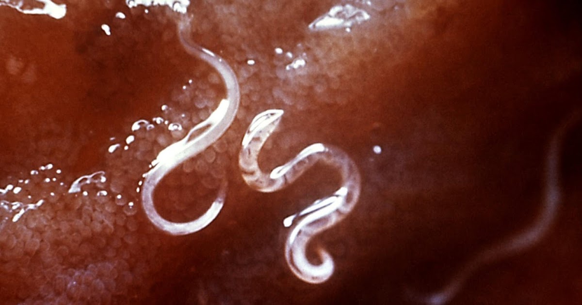 Los Oxiuros, esos fastidiosos parásitos. Lo que debes saber.