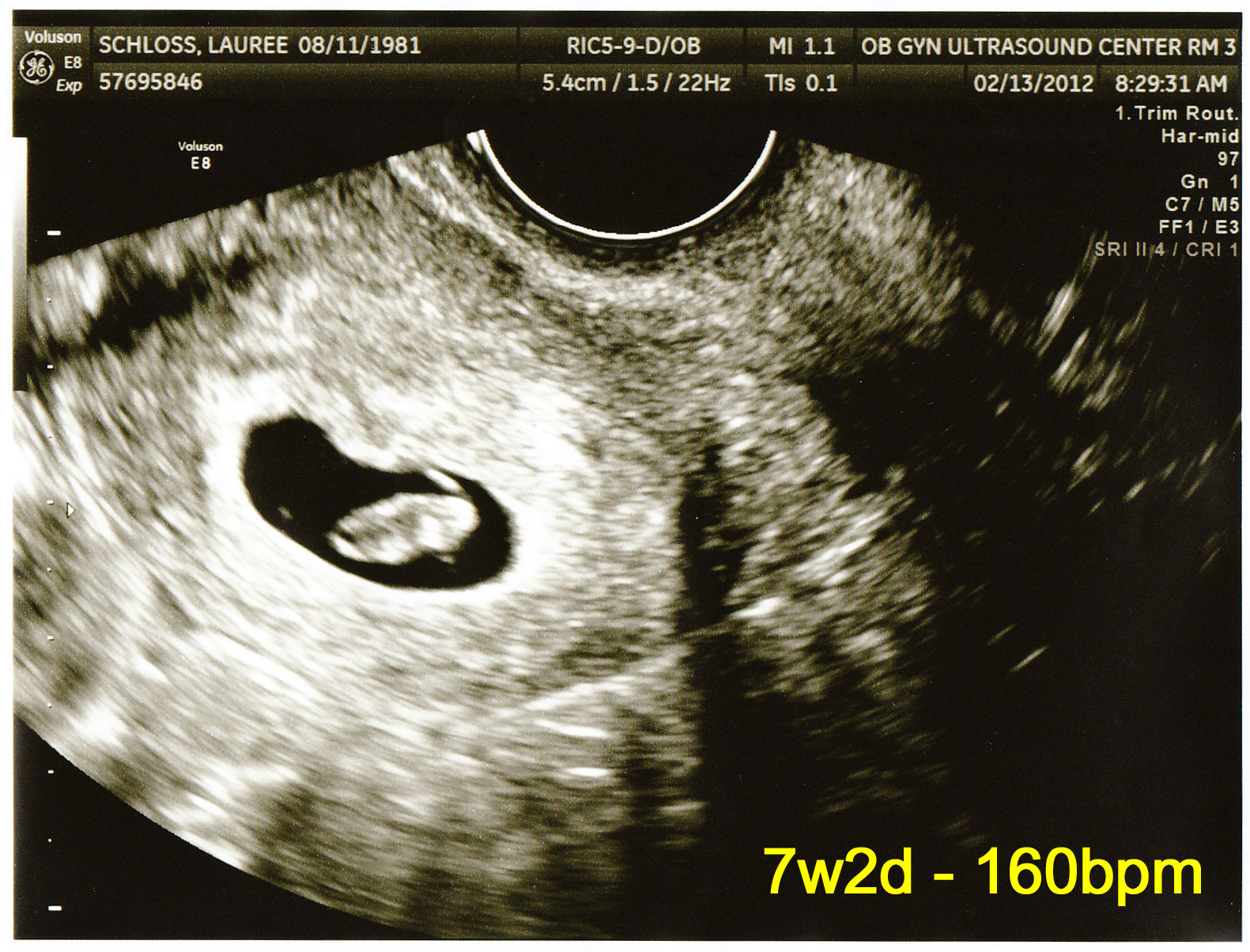 Just Relax and It Will Happen: 7w2d - Ultrasound!!