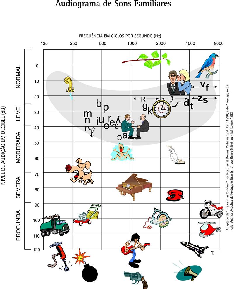 FONOAUDIÓLOGA RJ - DRA. ROBERTA PEREIRA: A Audiometria e o Audiograma