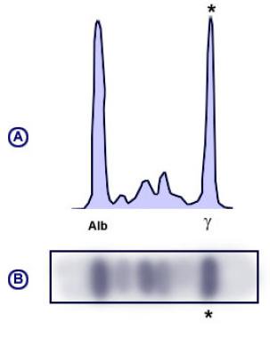 Immunology: Immunoglobulin Structure, Function: MCQ