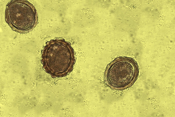 Medical Laboratory and Biomedical Science: Particles in Human Stool