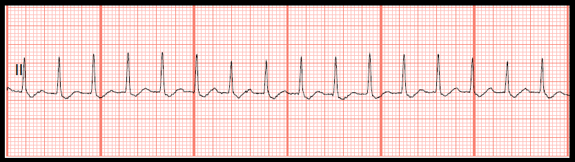 Basic Rhythm Test 27