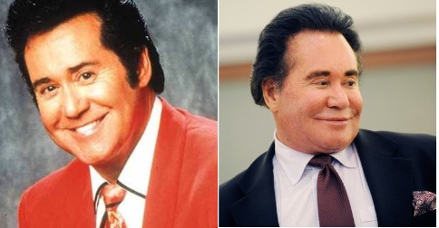 Wayne Newton Plastic Surgery