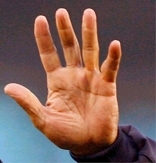 Unusual (Rare Lines & Shapes) Palm Image | INDIAN PALMISTRY ~ INDIAN ...