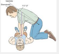 RESUSITASI JANTUNG DAN PARU | LASKAR KESEHATAN