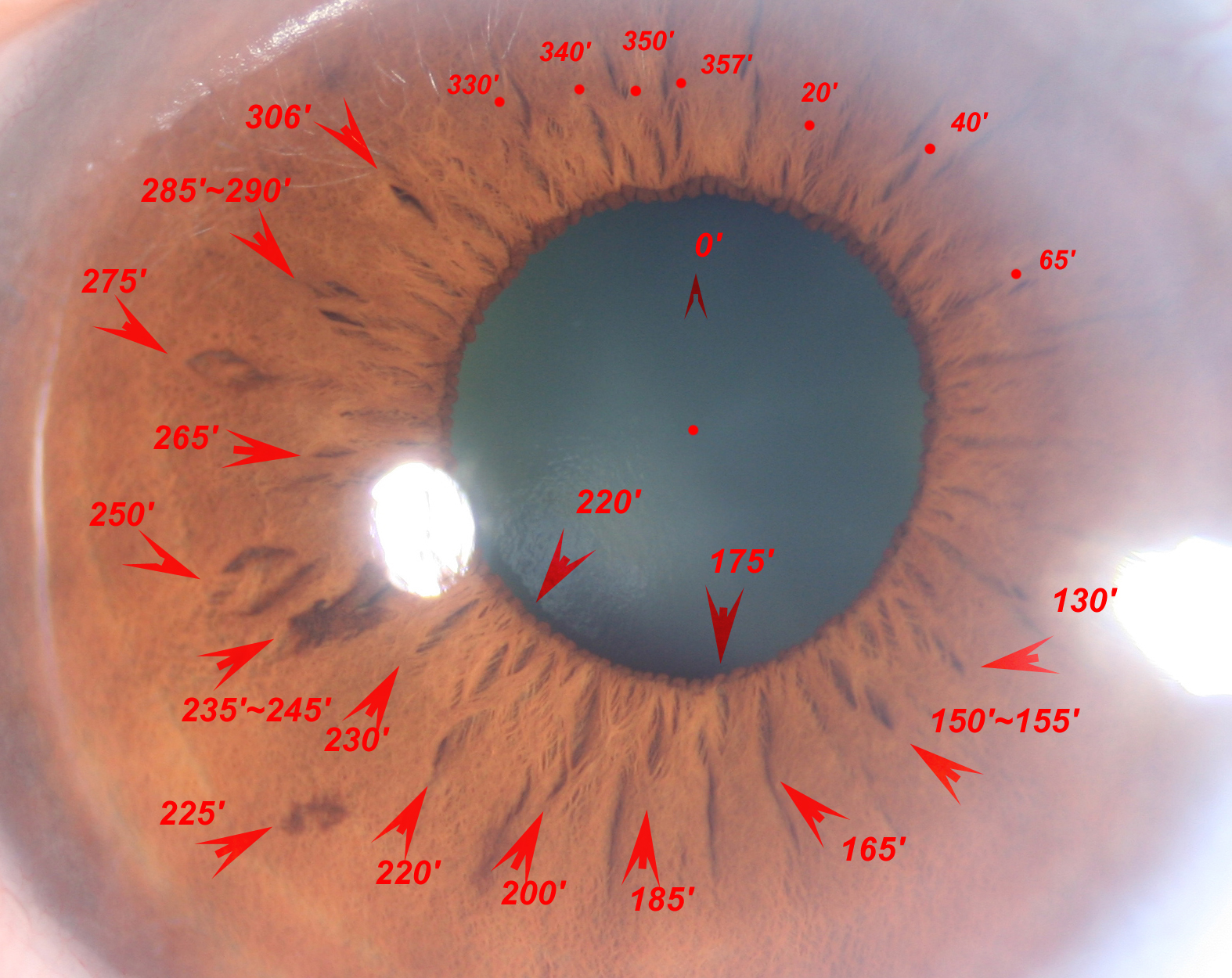 Modern & Multidimensional Iridology: Multidimensional Iridology ...