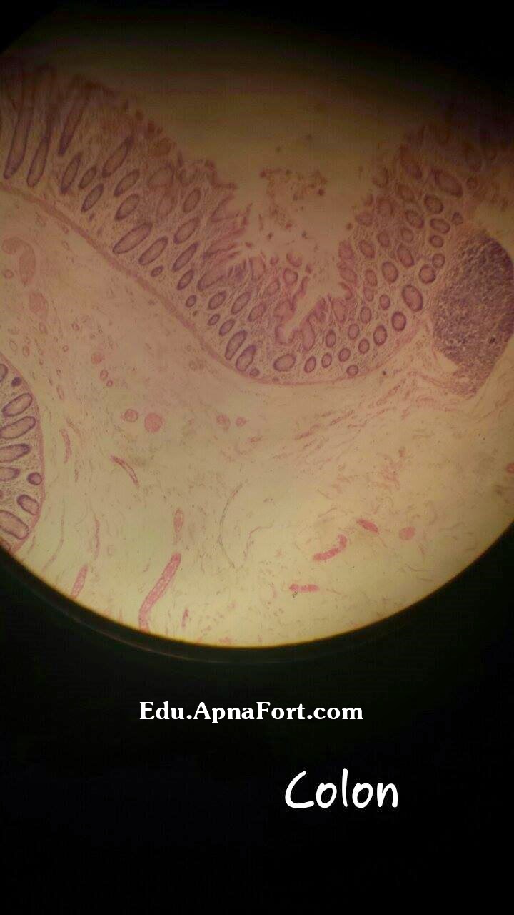 Educational Blog : Colon slides