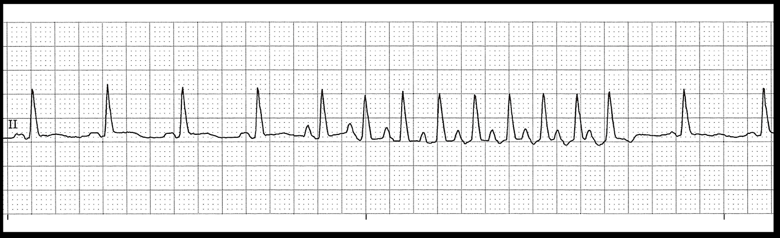 EKG Quiz 321