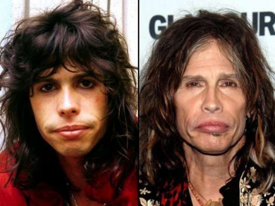 Steven Tyler Plastic Surgery Before and After Botox Injections and ...
