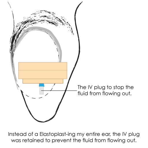 That Iffy Ear and His Healing Touch - For him and Him