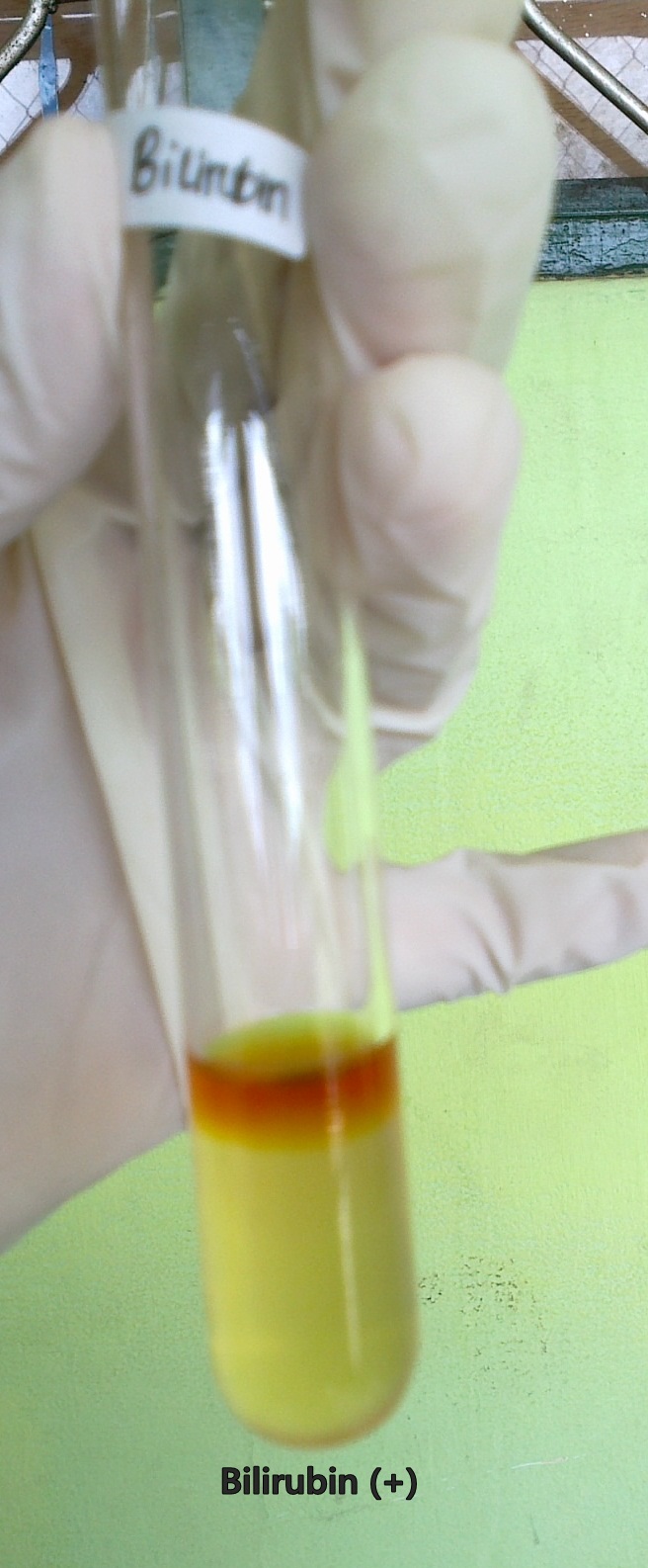 Pemeriksaan Urinalisis Lengkap | Analis Kesehatan