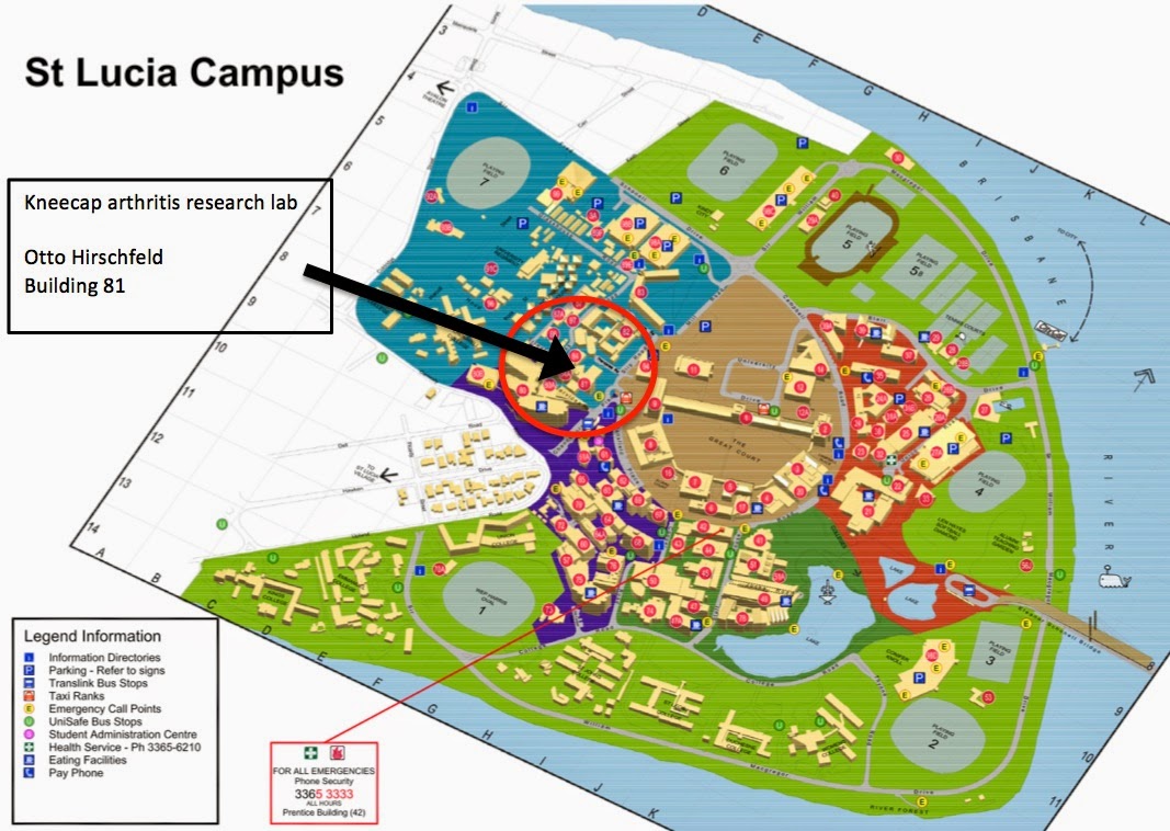 Do you have pain in the front of your knee?: Kneecap arthritis study