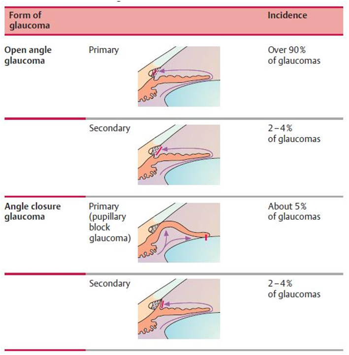 AMBITIOUS MEDICAL TEAM: Glaukoma Sekunder