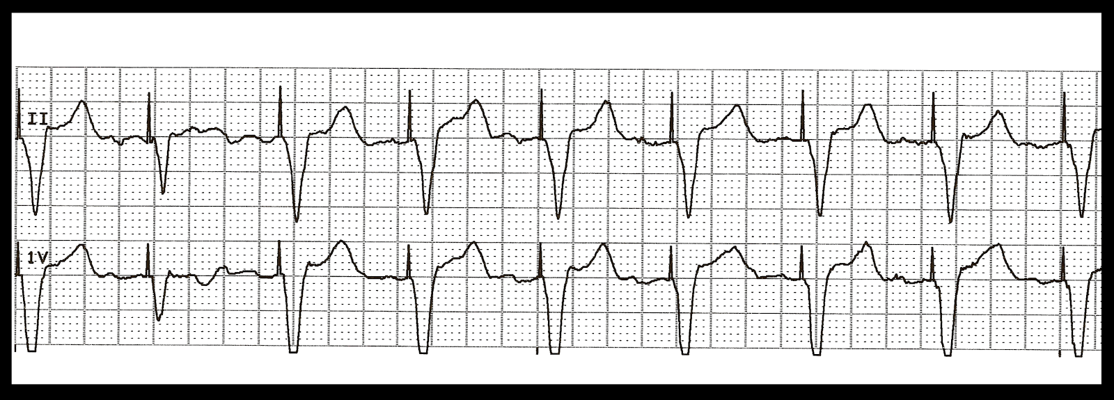 Practice Rhythm Strips 294