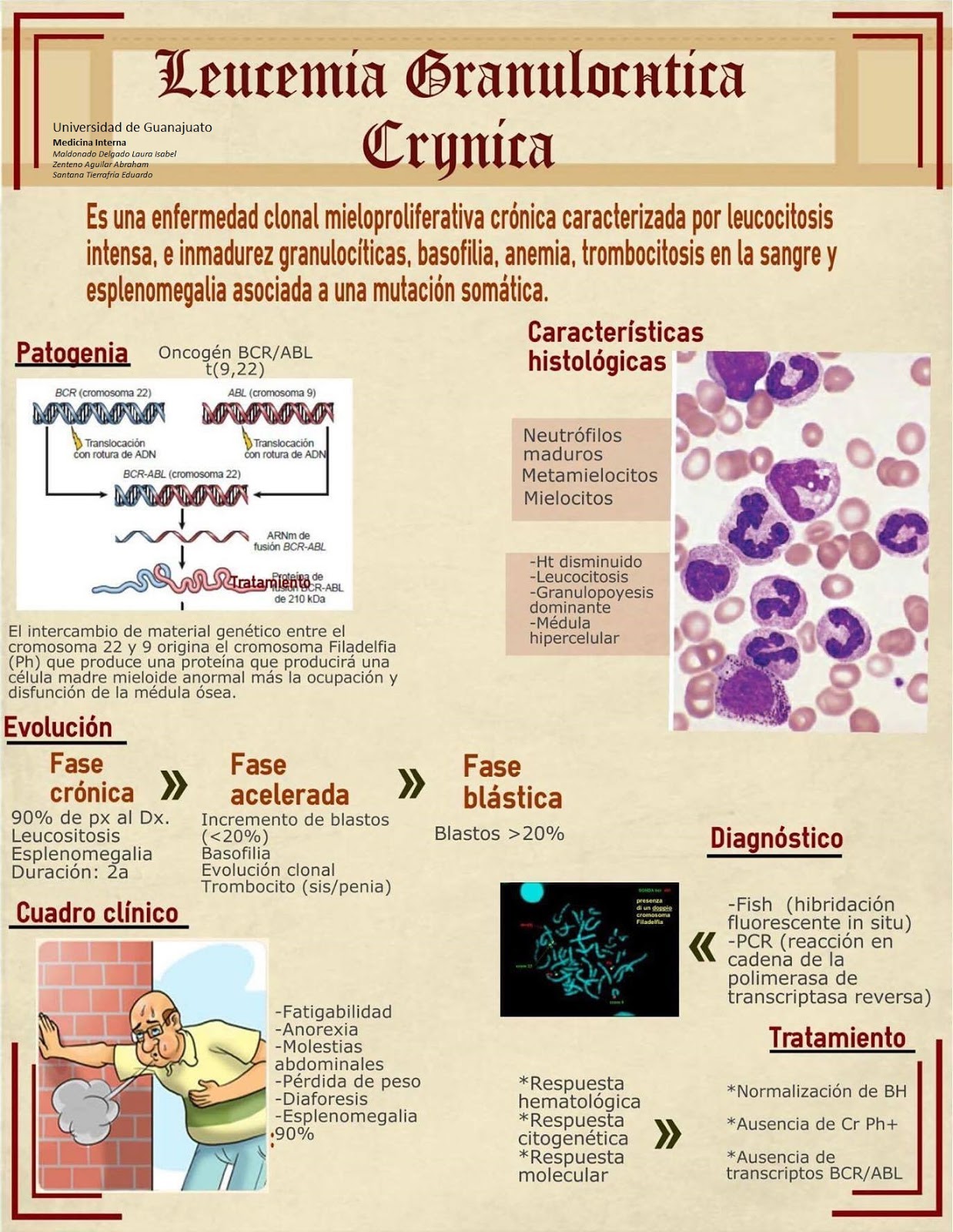 DIVULGACIÓN CIENTÍFICA UG: Leucemia Granulocítica Crónica