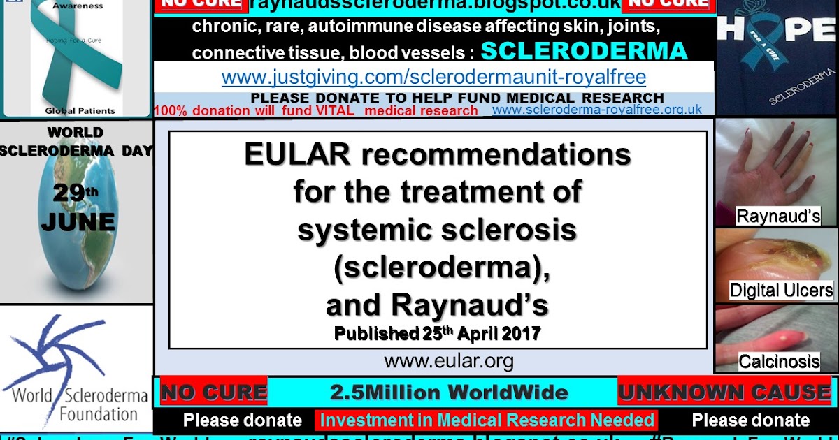 Raynauds Scleroderma Global Patients: EULAR Recommendations For The ...