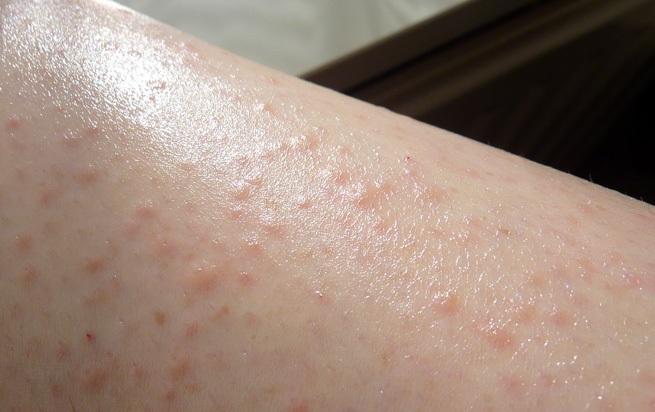 Click and Make-Up Beauty Blog: Review | Braun Silk-épil 7 Wet + Dry ...