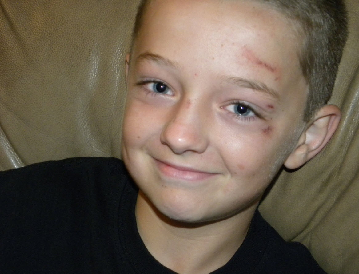 The Blackham Bunch: Scraped Up Faces