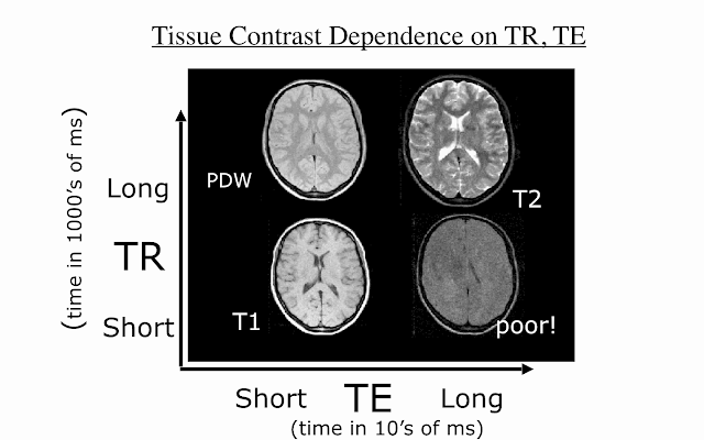 Magnetic Resonance Imaging (MRI) in Orthopaedics