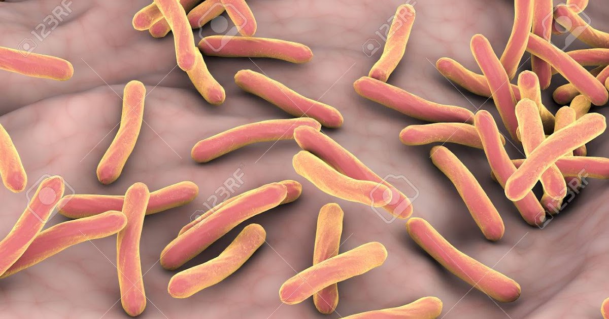 Acid-Fast Bacillus (AFB) Testing ~ WebMLT