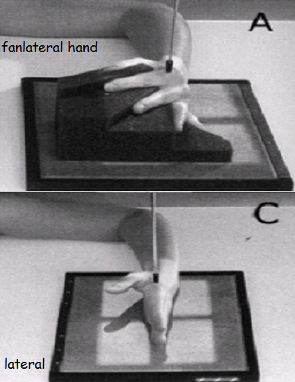 Teknik pemeriksaan X Ray Manus - Seputar Kesehatan