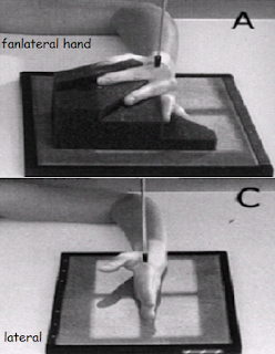 Teknik pemeriksaan X Ray Manus - Seputar Kesehatan
