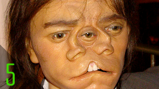 5 Most Incredible Sideshow Freaks. The three-eyed man - Trending Hitz