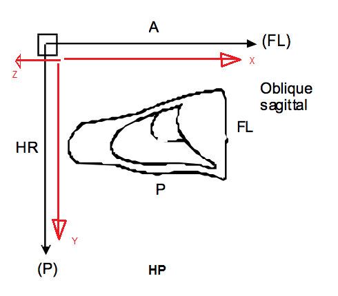 DICOM is Easy: Getting Oriented using the Image Plane Module