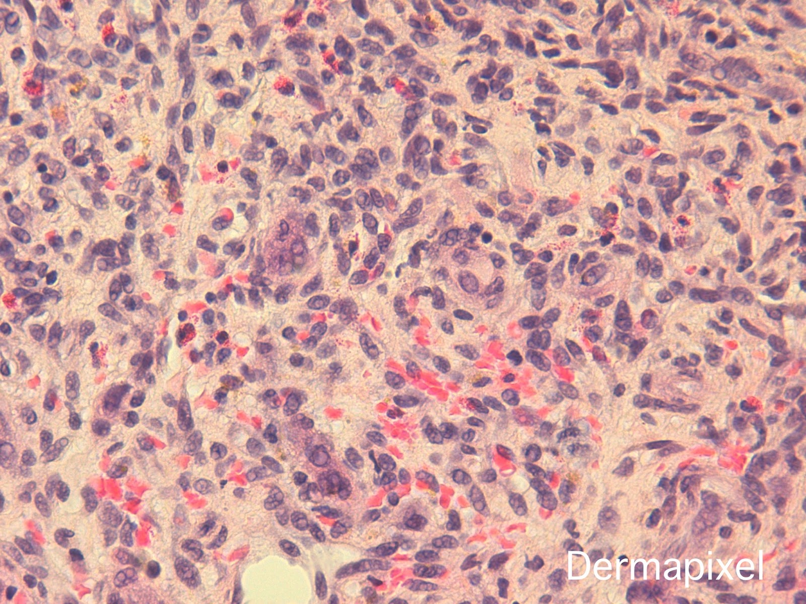 Dermapixel: mayo 2019