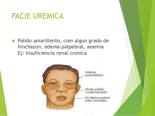 utesadultadorvil.squirurgica: mayo 2015