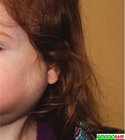 [Pediatric] Atlas of Lymphadenopathy | Free Medical Atlas