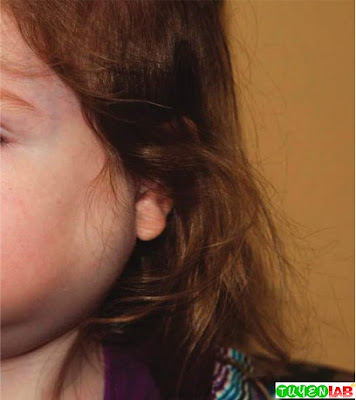 [Pediatric] Atlas of Lymphadenopathy | Free Medical Atlas