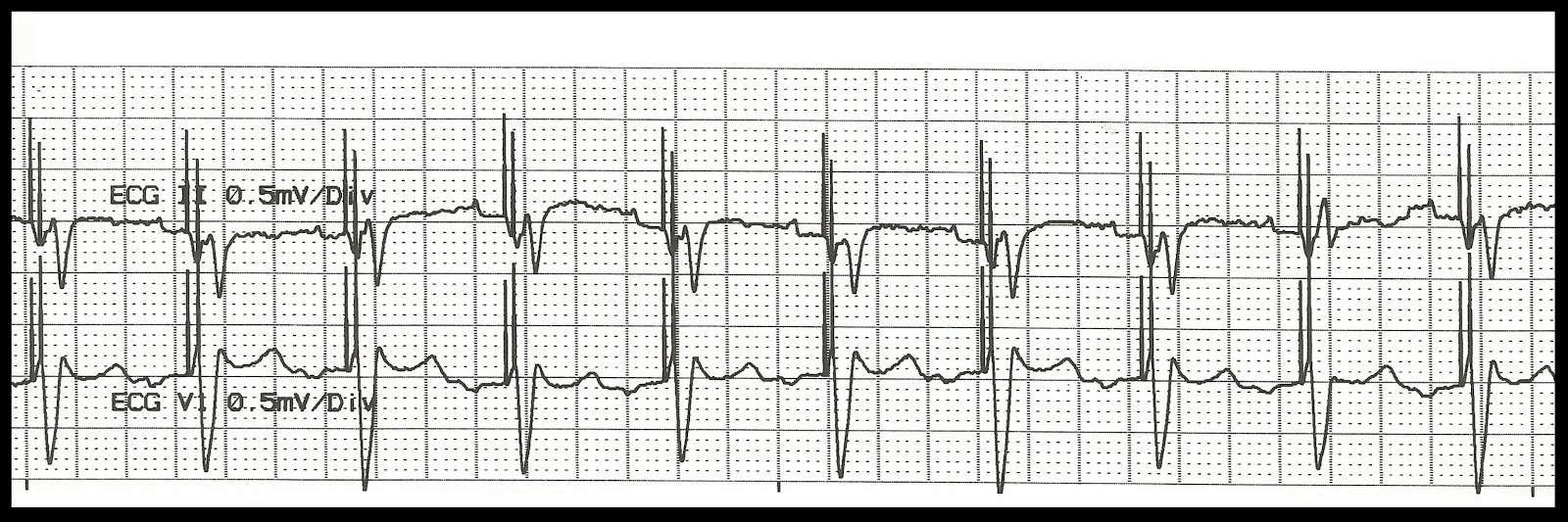 Practice EKG Rhythm Strips 198