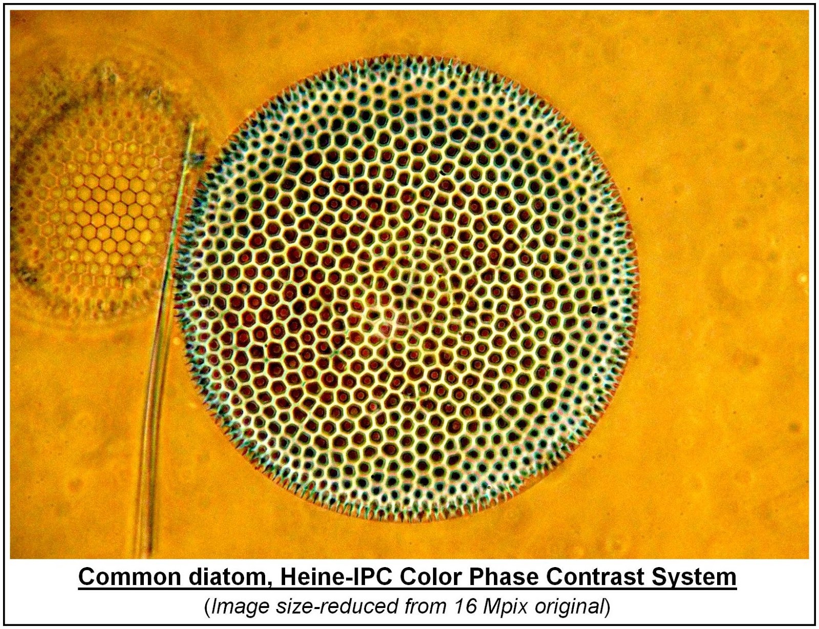 Better Microscopy -- the blog : 'Heine-IPC': COLOR Phase Contrast ...