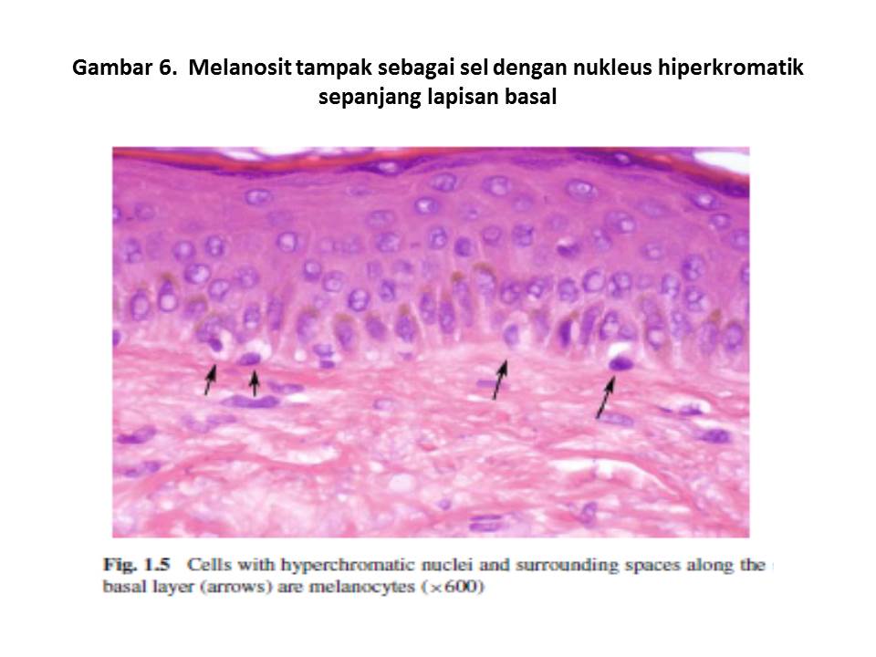 Reza Aditya Digambiro: Histologi Kulit Normal dan Perubahan yang ...