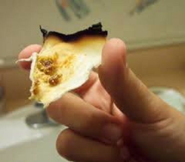 Cone Chinês-Hindu para Limpeza e Desobstrução dos Ouvidos - Técnica ...